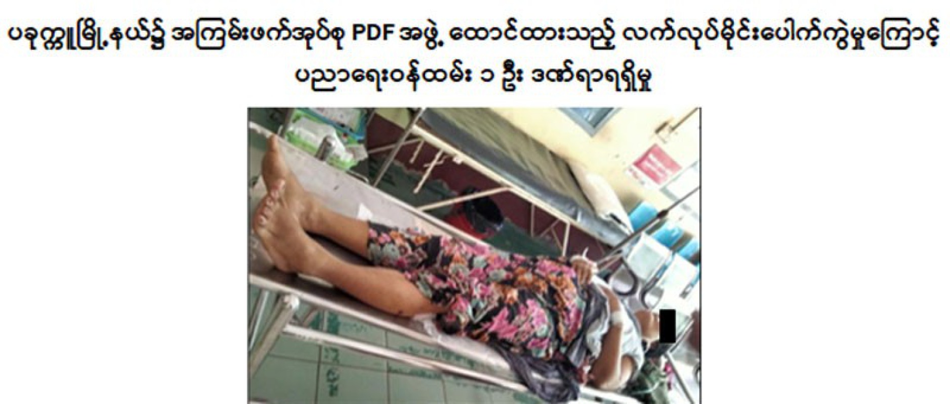 လက်လုပ်မိုင်းပေါက်ကွဲမှုကြောင့် ကျောင်းသို့စာသင်ကြားရန်သွားသည့် အလယ်တန